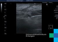 Hernien – Sonographieatlas Erlangen
