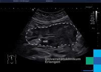 Lymph nodes – Atlas of Ultrasound