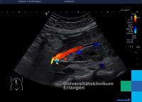 Lymph nodes – Atlas of Ultrasound