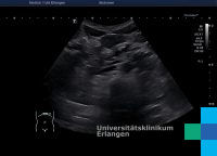 Normal kidney – Atlas of Ultrasound
