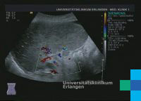 Sonstige Befunde – Sonographieatlas Erlangen