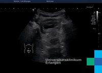 Sonstige Befunde – Sonographieatlas Erlangen