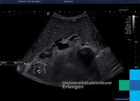 Sonstige Befunde – Sonographieatlas Erlangen