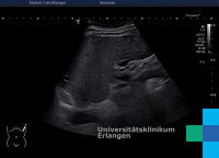 Sonstige Befunde – Sonographieatlas Erlangen
