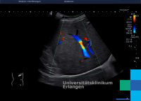 Liver vessels – Atlas of Ultrasound