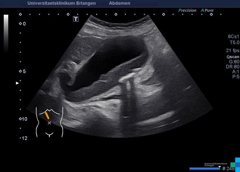 Artefakte – Sonographieatlas Erlangen