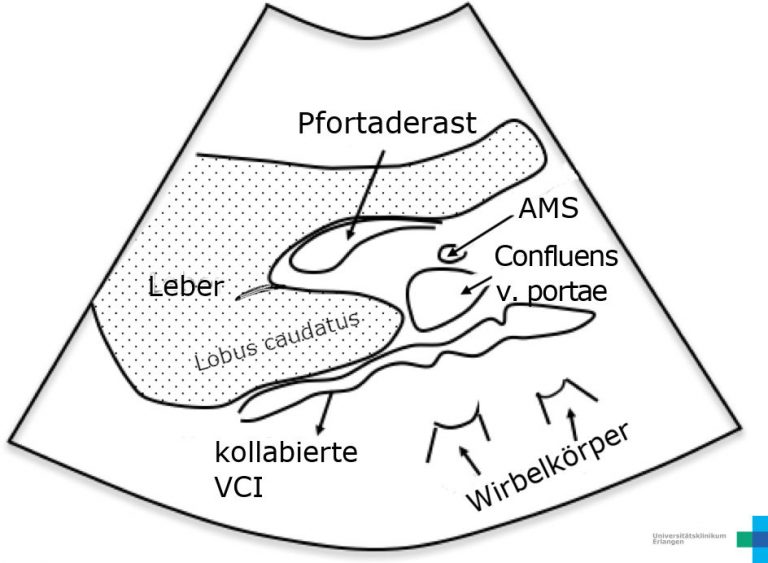 Normalbefunde Leber – Sonographieatlas Erlangen