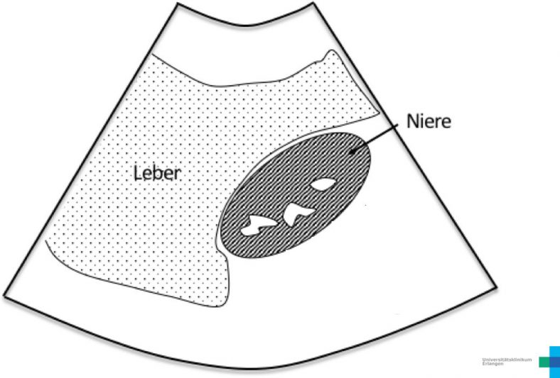 Normalbefunde Leber – Sonographieatlas Erlangen