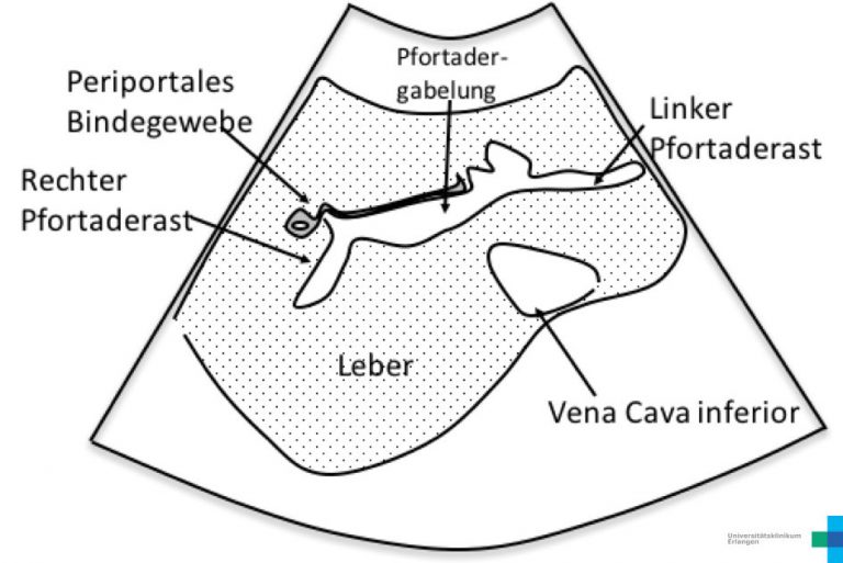 Normalbefunde Leber – Sonographieatlas Erlangen