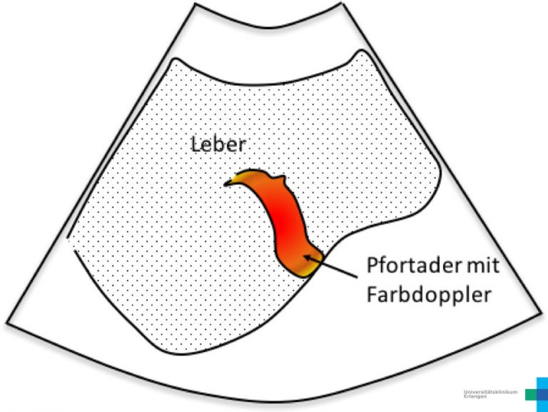 Normalbefunde Gallenwege, Leberpforte – Sonographieatlas Erlangen