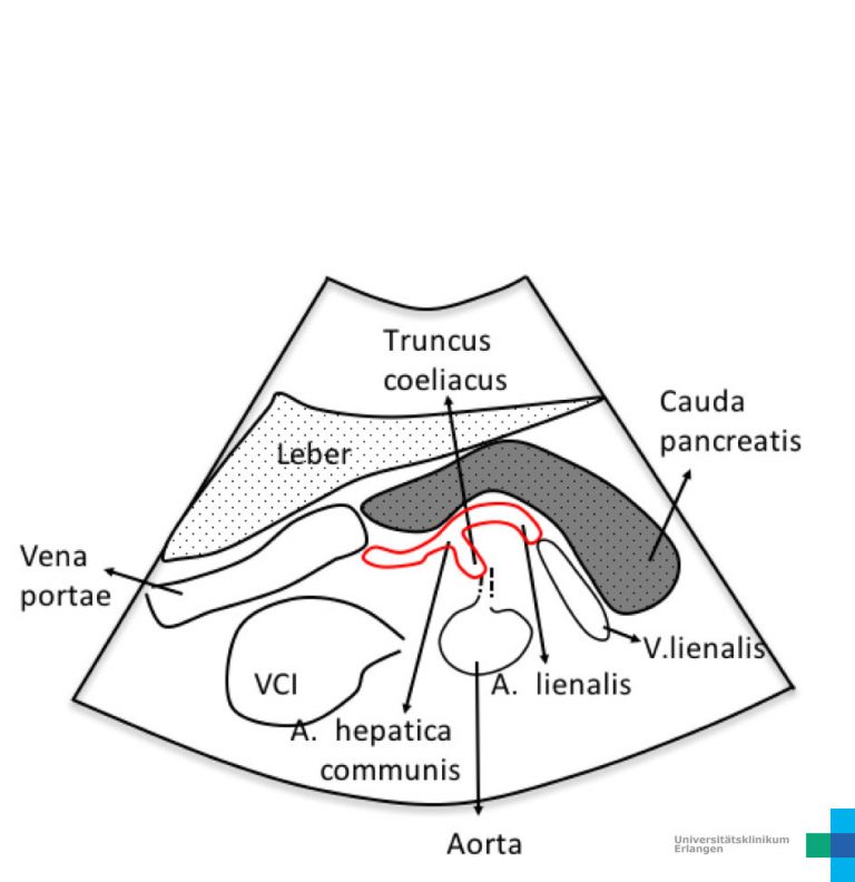 Normalbefunde Bauchgefäße – Sonographieatlas Erlangen