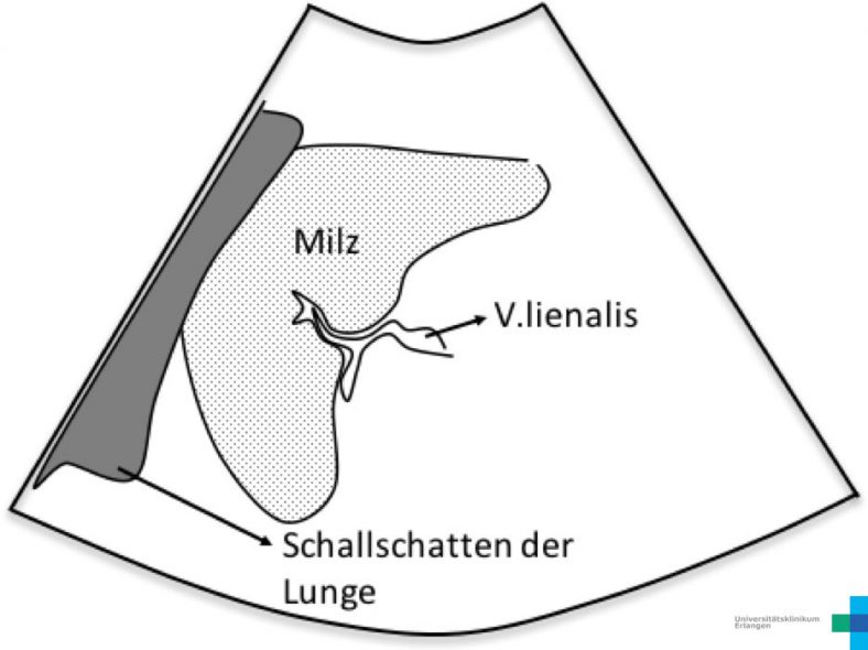 Normalbefunde Milz – Sonographieatlas Erlangen