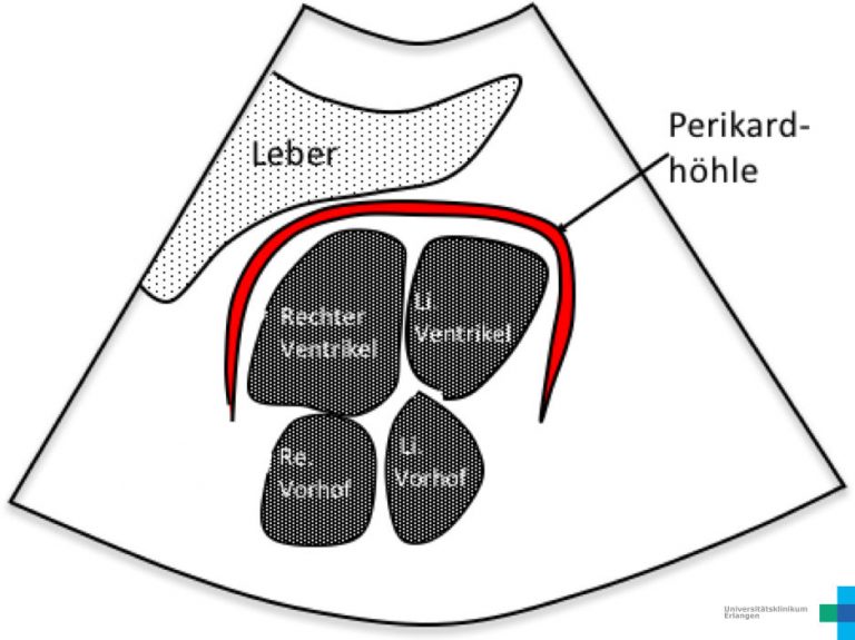 Normalbefunde FAST – Sonographieatlas Erlangen