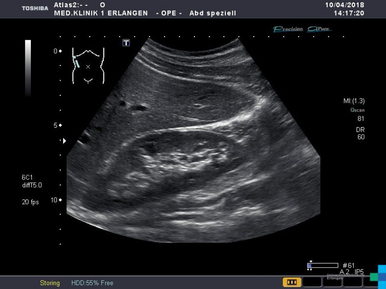 Normalbefunde FAST – Sonographieatlas Erlangen