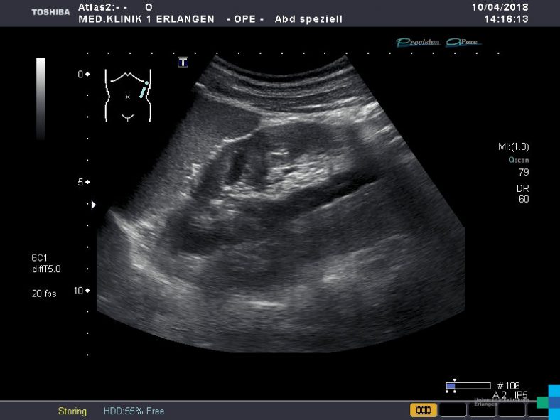 Normalbefunde FAST – Sonographieatlas Erlangen