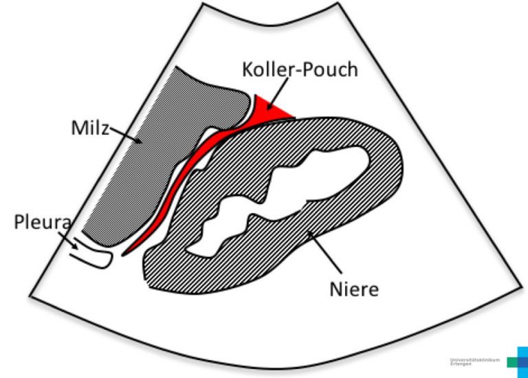 Normalbefunde FAST – Sonographieatlas Erlangen