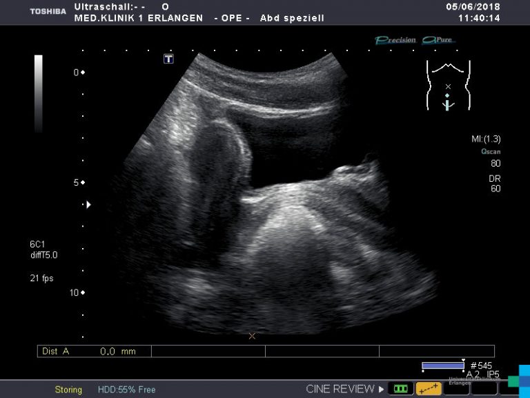 Normalbefunde FAST – Sonographieatlas Erlangen