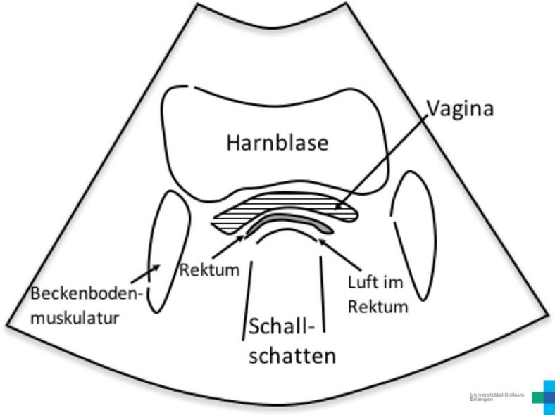 Normalbefunde FAST – Sonographieatlas Erlangen