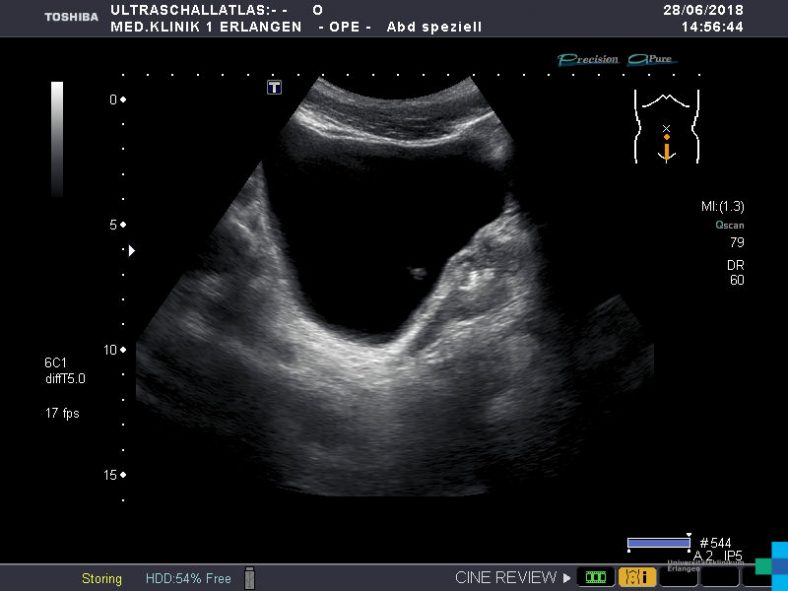Normalbefunde FAST – Sonographieatlas Erlangen