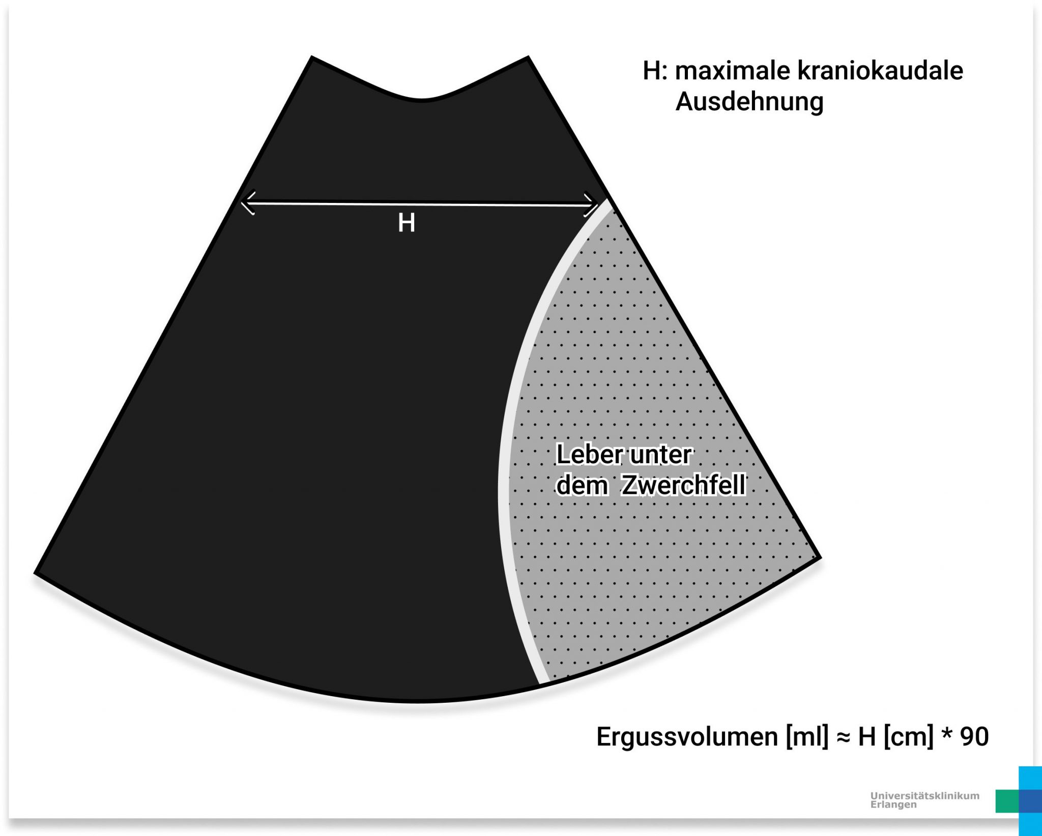 Pathologien Pleura – Sonographieatlas Erlangen
