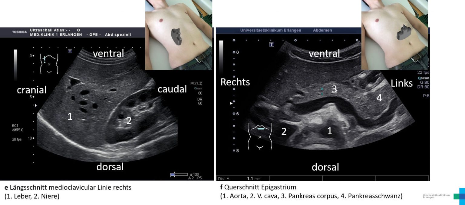 Schallebenen, Körperebenen, und Orientierung am Bildschirm ...