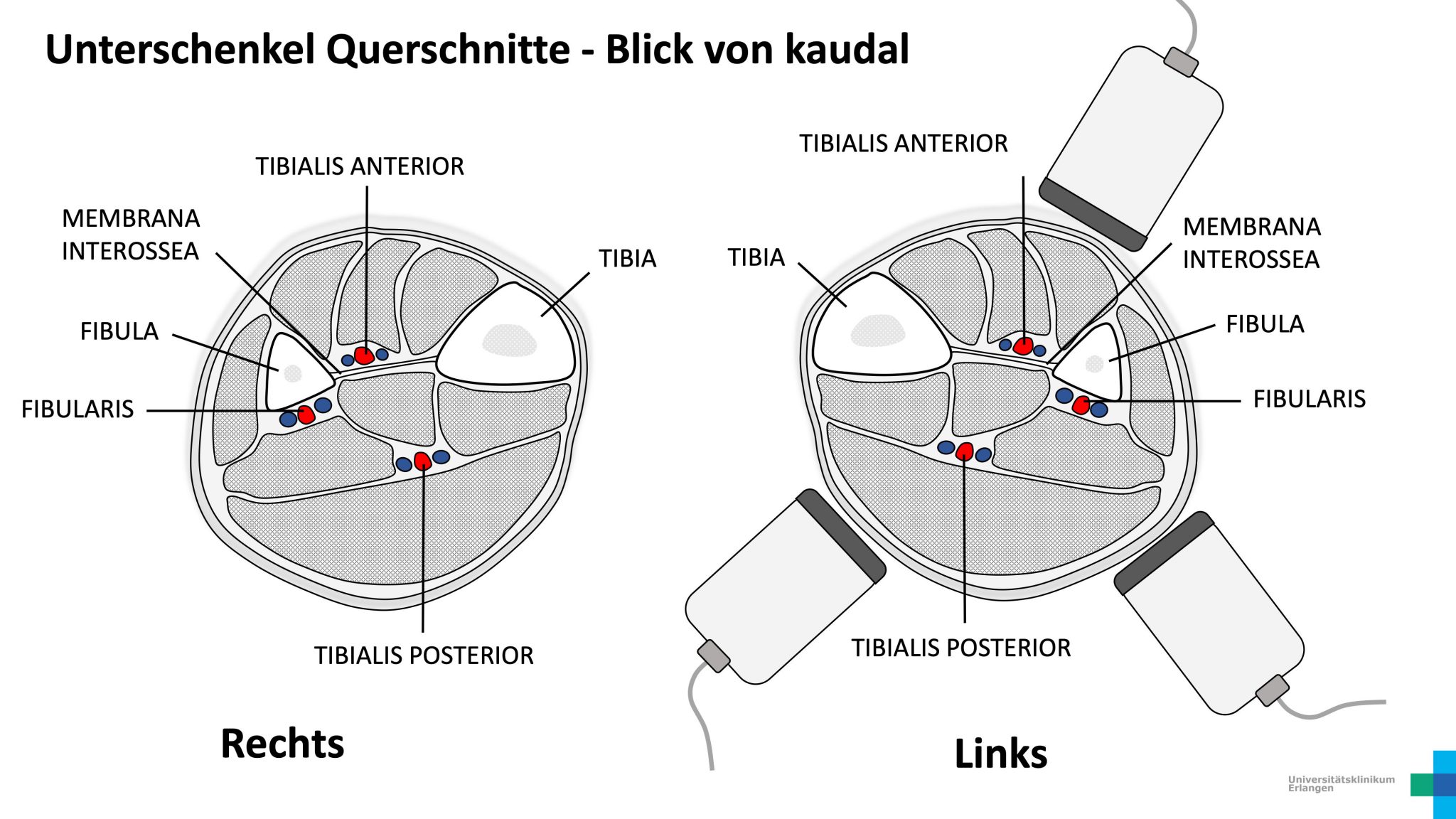Thrombosediagnostik Unterschenkel – Sonographieatlas Erlangen
