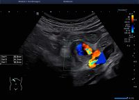 Lebergefäße – Sonographieatlas Erlangen