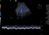 Lebergefäße – Sonographieatlas Erlangen